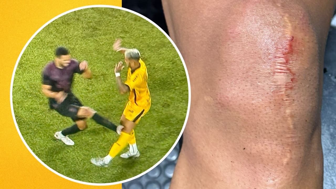Amazonas reclama da arbitragem em lance parecido de Gustavo Gómez ...